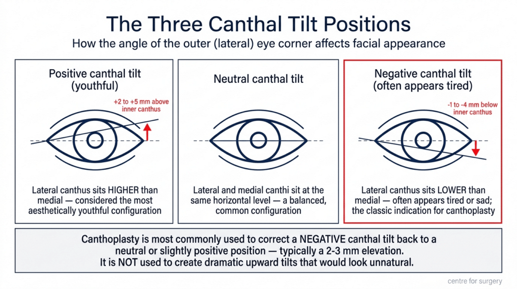 Canthoplasty London | Almond Eye Surgery UK | CFS
